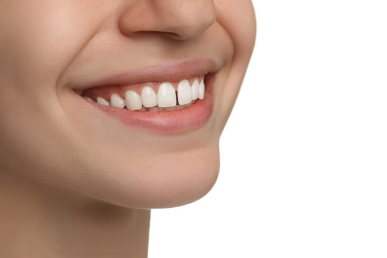Front Teeth Gap Best Dental Treatments In 2024